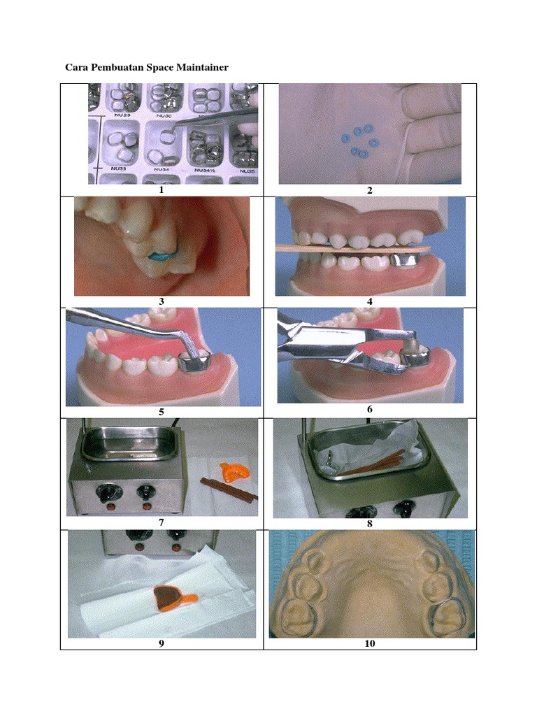 Cara Pembuatan Space Maintainer | PDF