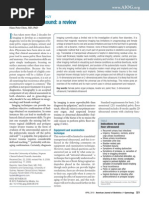 Indeks Wayne New Castle Hipertiroid | PDF