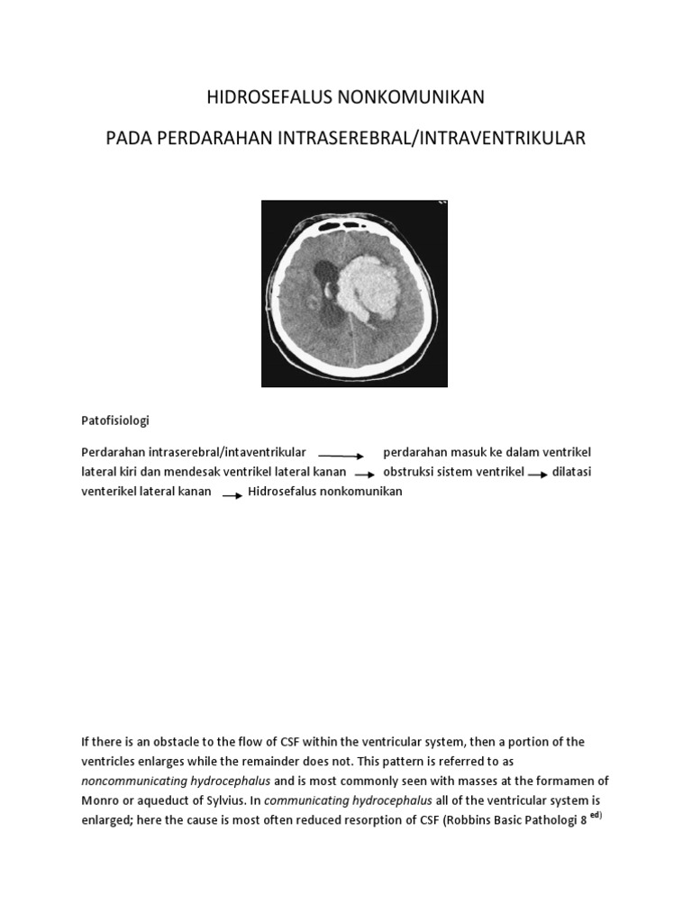 Hidrosefalus Nonkomunikan Pada Perdarahan Intraserebral ...