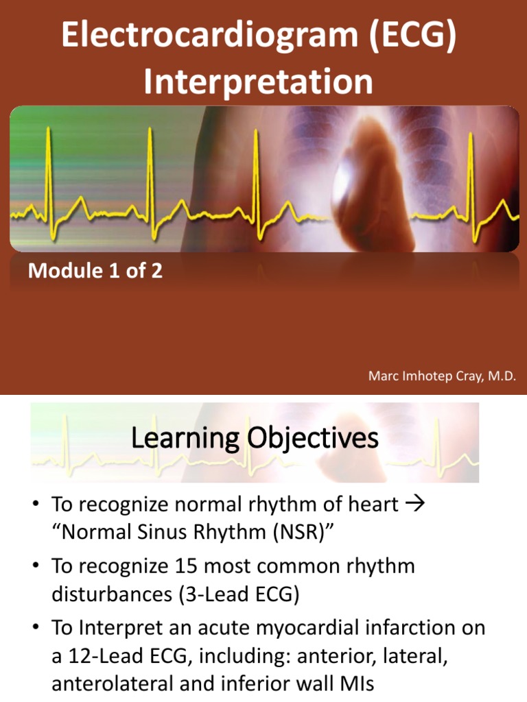 Electrocardiogram (ECG) Interpretation - Part 1 of 2 | PDF ...