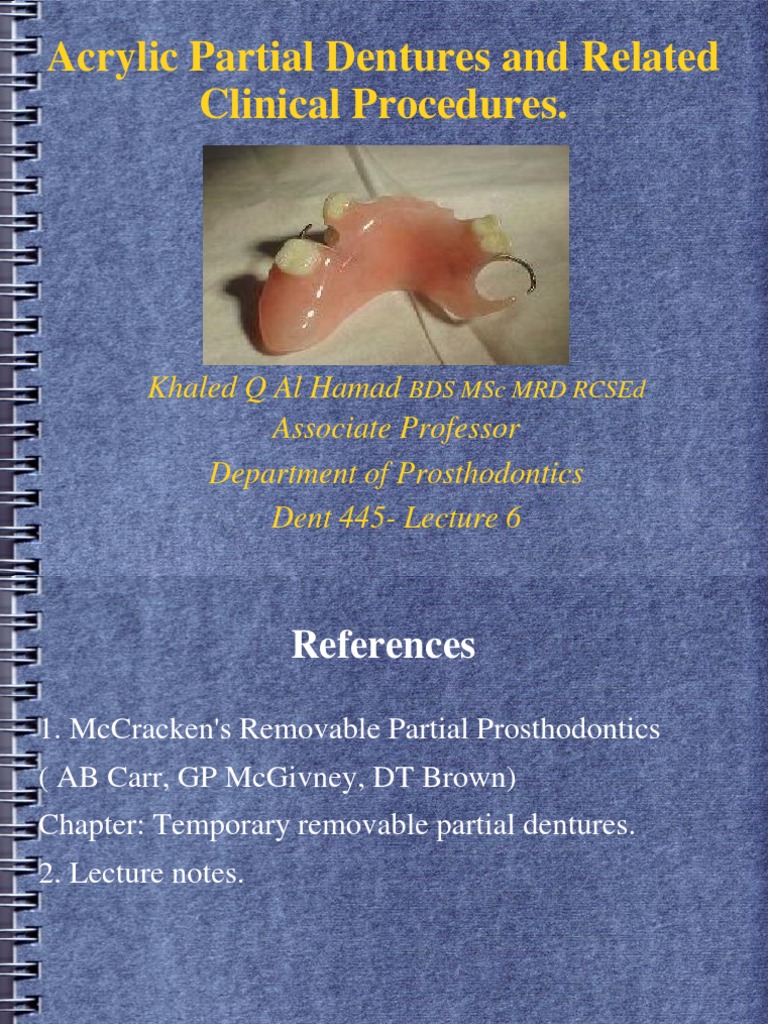 Lecture 6 Acrylic RPD | PDF | Dentures | Dentistry Branches