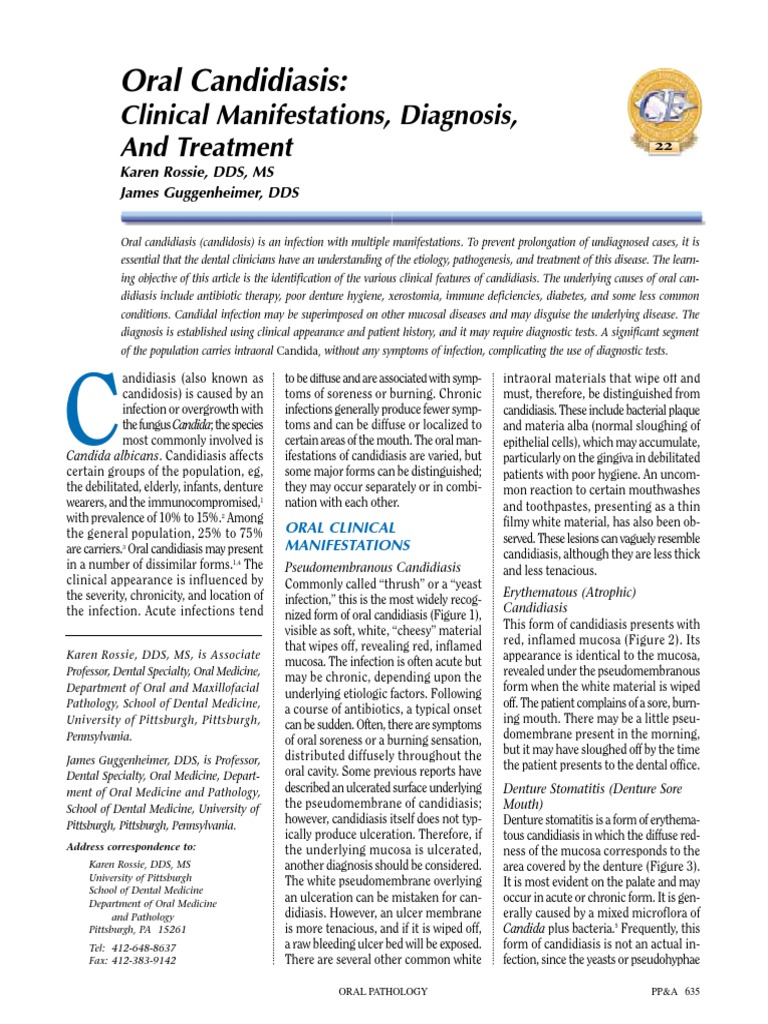 Oral Candidiasis:: Clinical Manifestations, Diagnosis, and Treatment | PDF