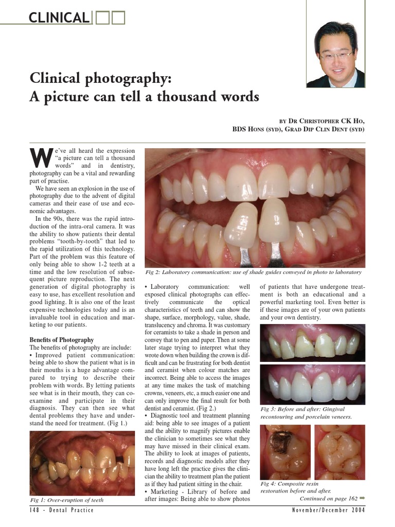 Clinical Photography: A Picture Can Tell A Thousand Words | PDF ...