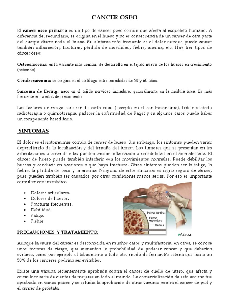 Cancer Oseo | Hueso | Cáncer
