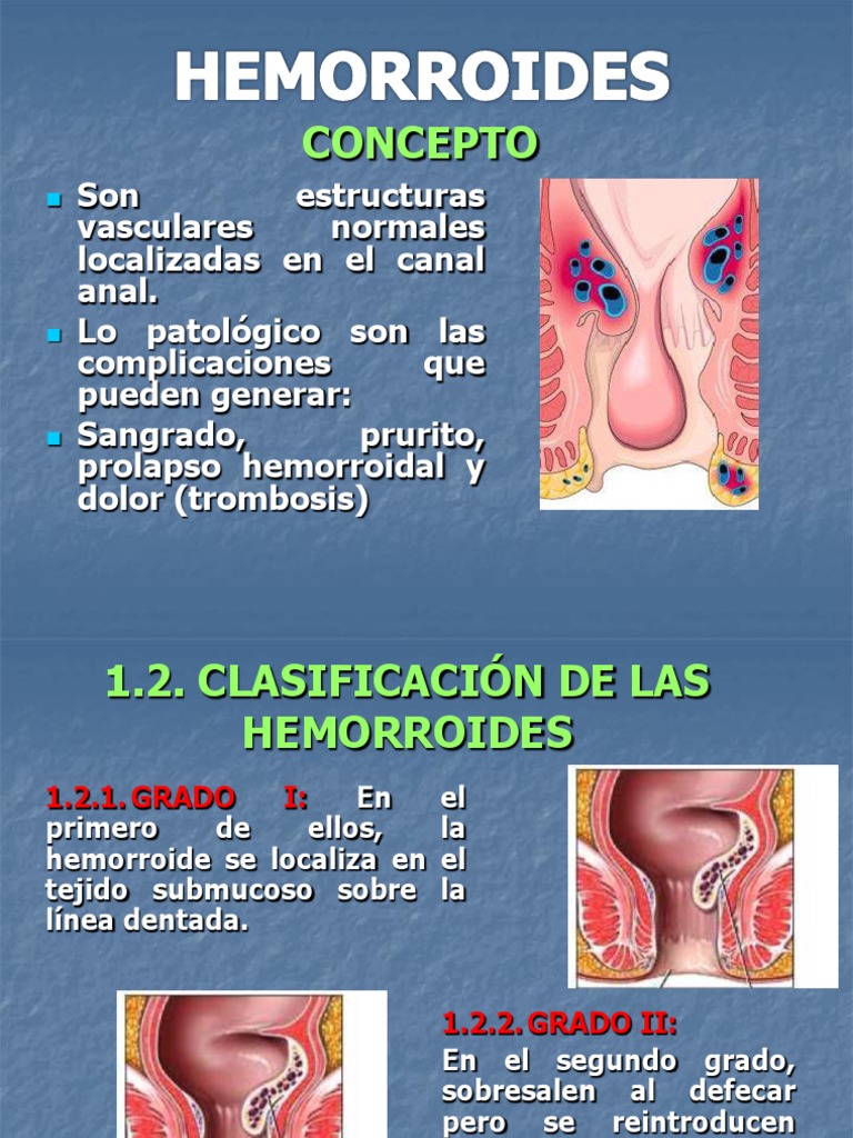 Hemorroides | PDF | Hemorroides | Especialidades Medicas