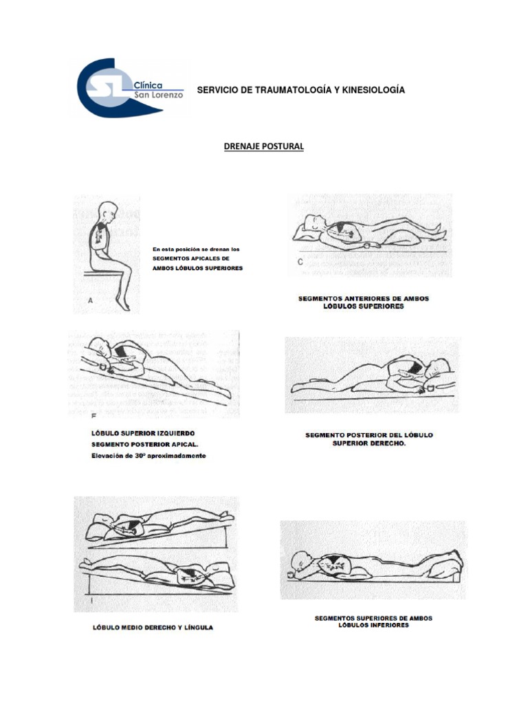 Drenaje Postural | PDF