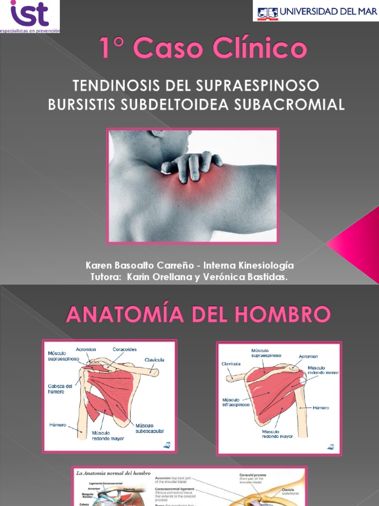 Bursitis Subacromial y Subdeltoidea | PDF | Hombro | Tejido suave