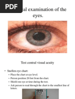 Confrontation Visual Fields - A Guide For Ophthalmologists in Training ...