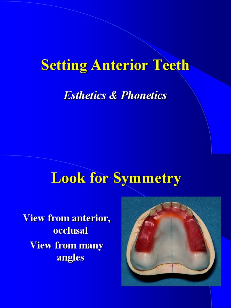 Anterior Teeth Setting | PDF