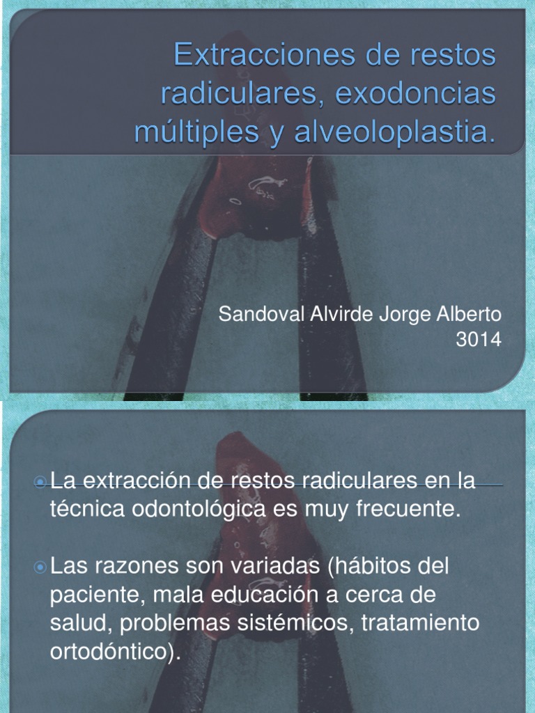 Extracciones de Restos Radiculares, Exodoncias Múltiples y | PDF