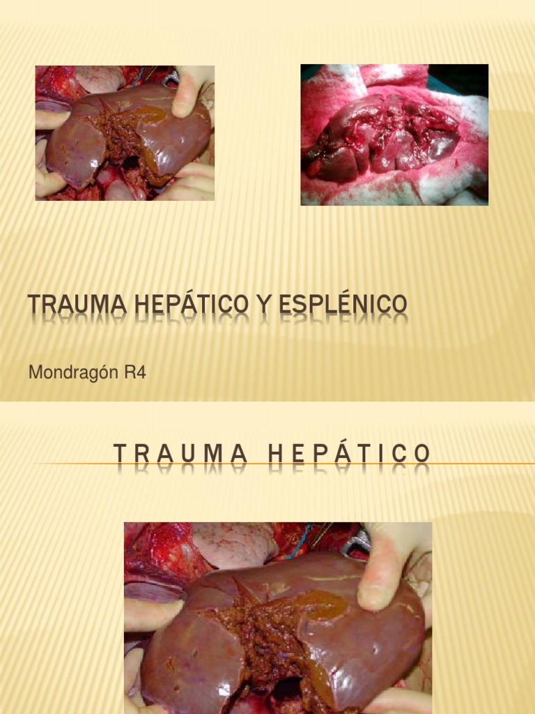 Trauma Hepático y Esplénico | PDF | Lesión | Abdomen