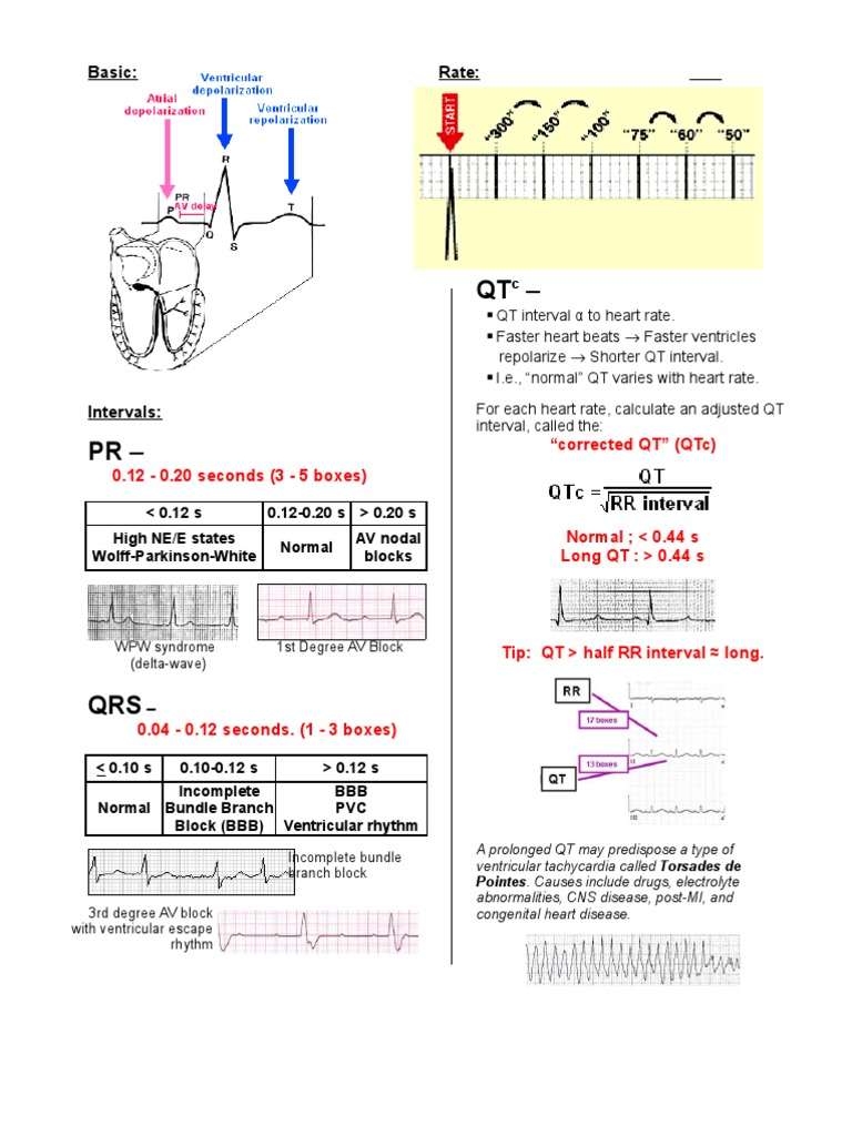 A Simplified ECG Guide | PDF | Electrocardiography | Circulatory System