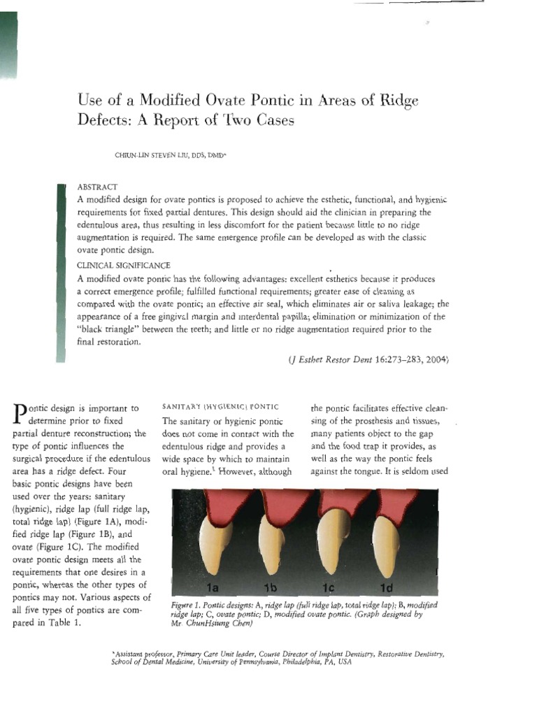 Modified Pontic Design For Ridge Defects | PDF | Dentures | Medical ...