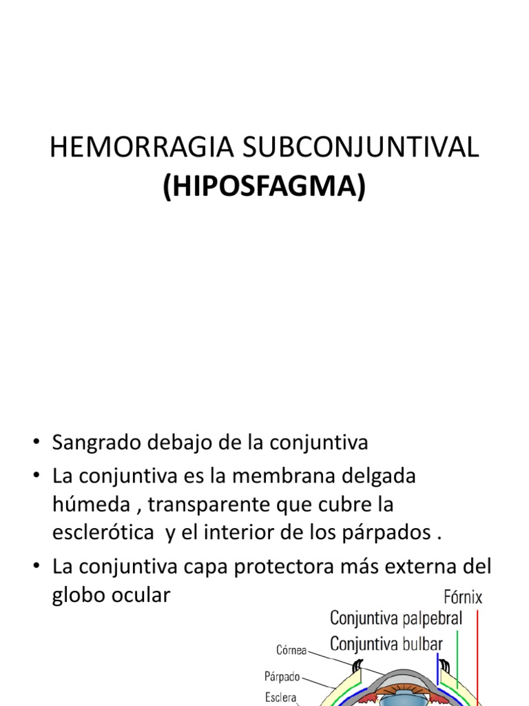 Hemorragia Subconjuntival | PDF | Ojo humano | Córnea