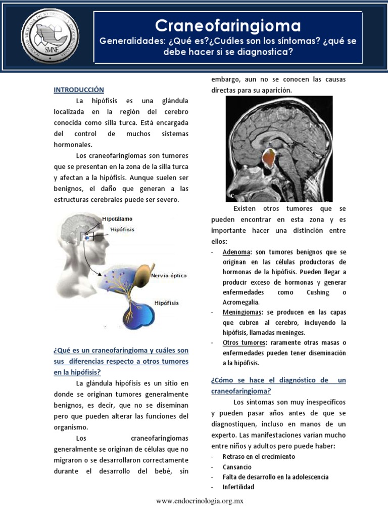 Craneofaringioma Generalidades | PDF