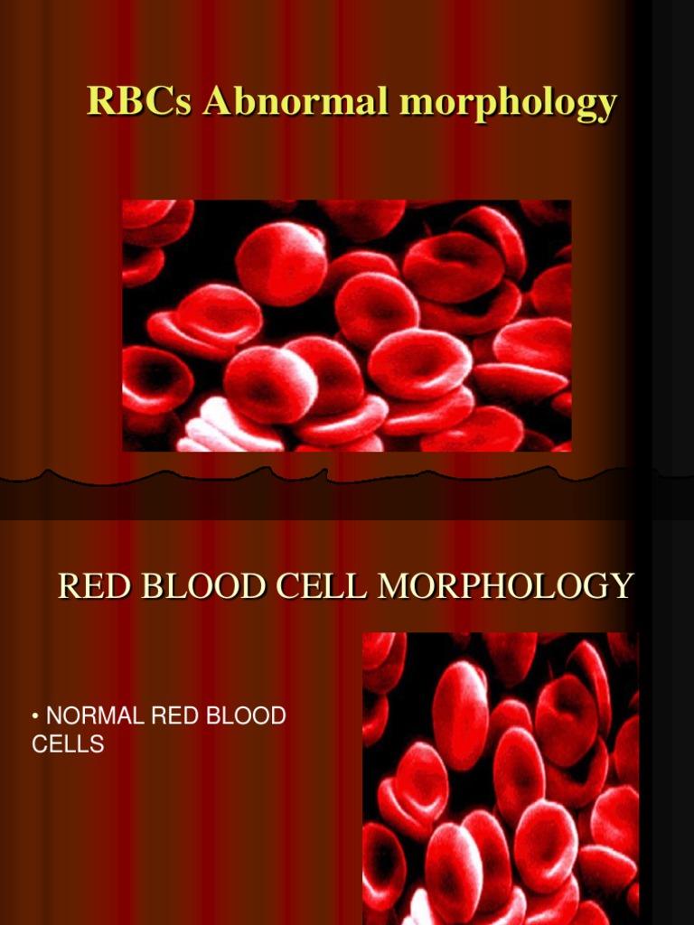 Abnormal RBC Morphology Guide | PDF | Anemia | Red Blood Cell