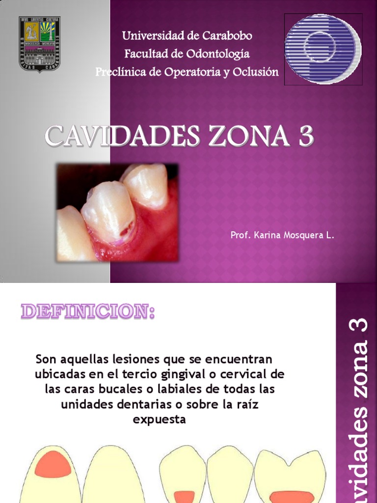 Lesiones no cariosas en el tercio cervical de los dientes ...