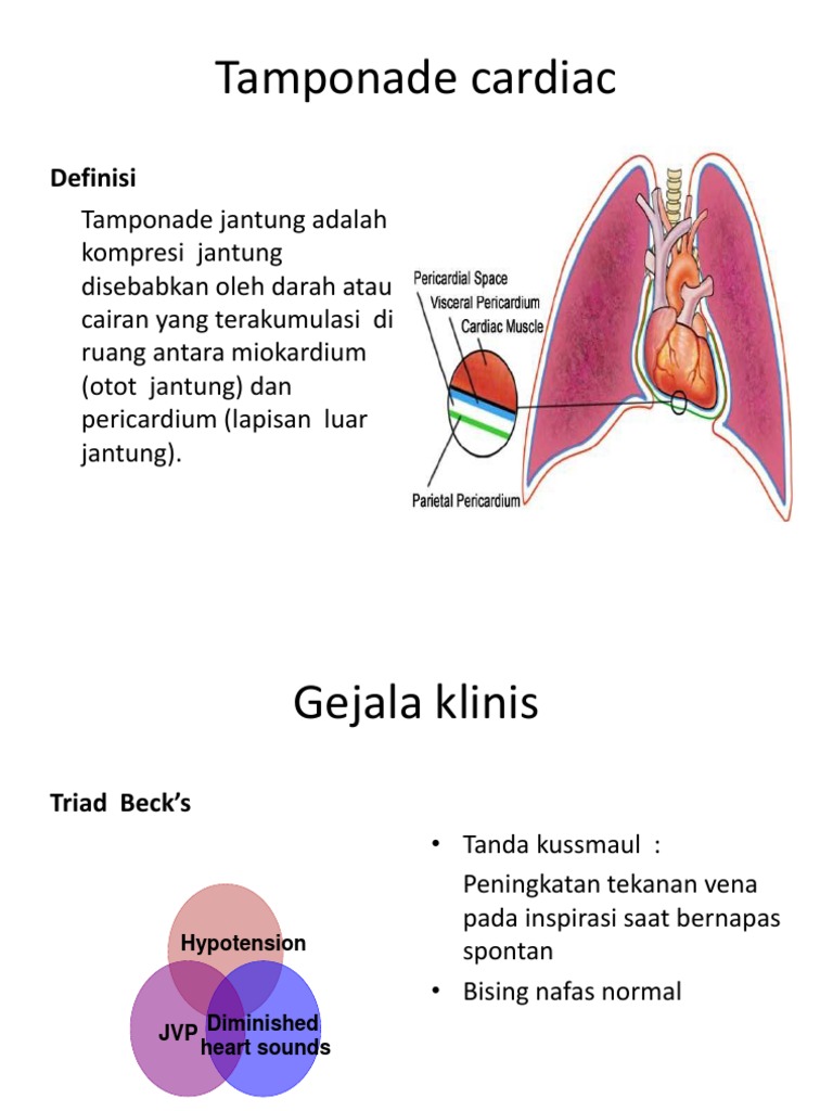 Tamponade Cardiac | PDF