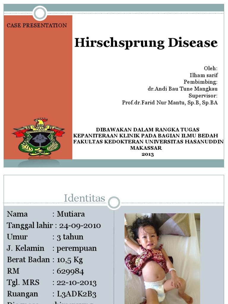 Hisprung Disease | PDF