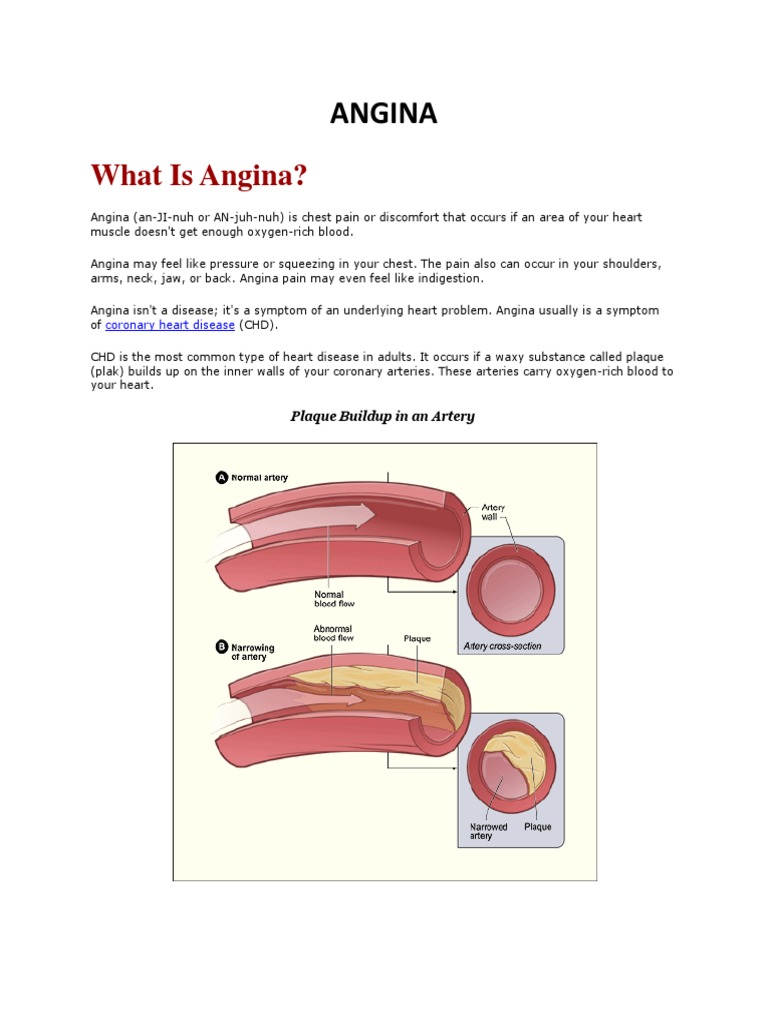 What Is Angina? | PDF | Angina Pectoris | Coronary Artery Disease