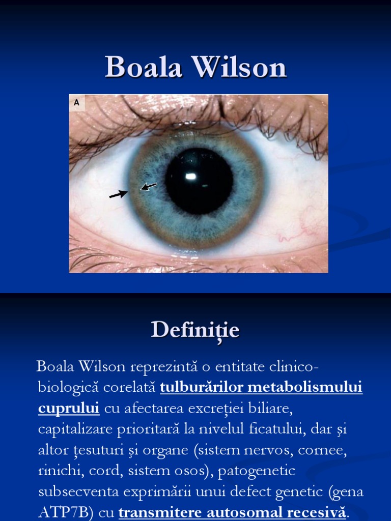 Boala Wilson | PDF
