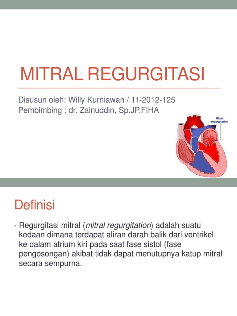 Mitral Regurgitasi | PDF
