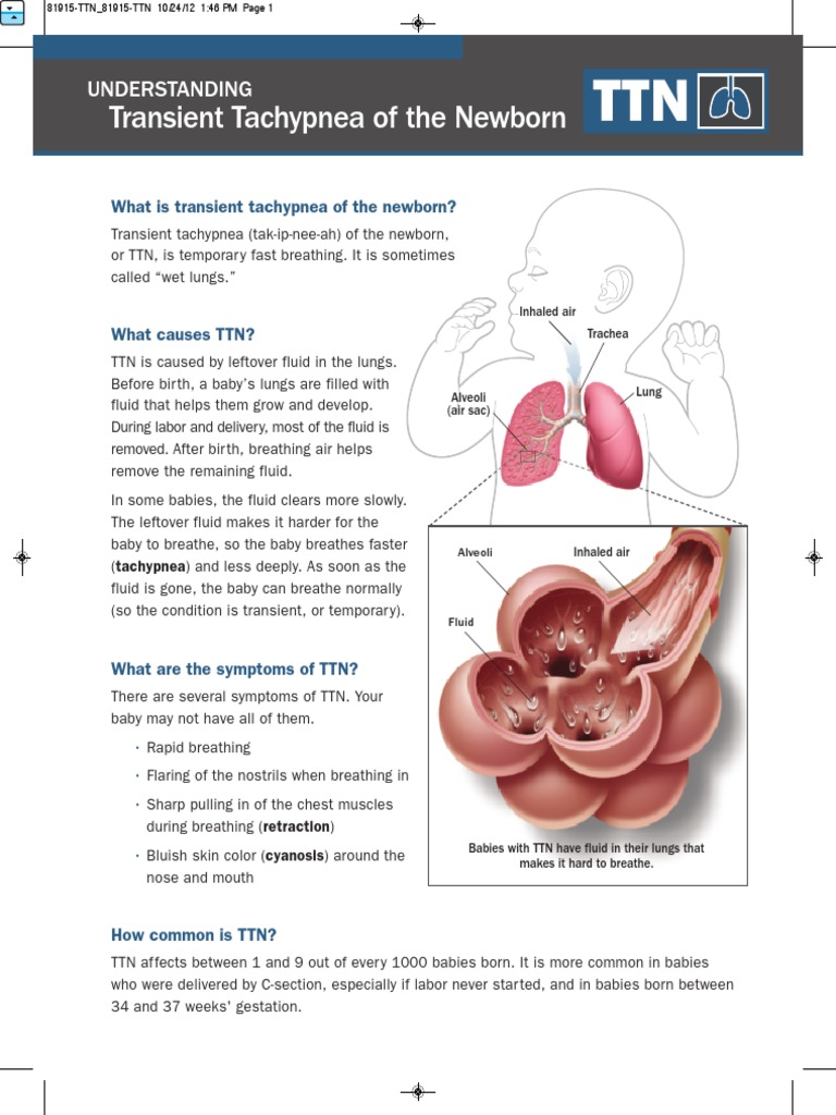 Transient Tachypnea of The Newborn English | PDF | Breathing | Lung