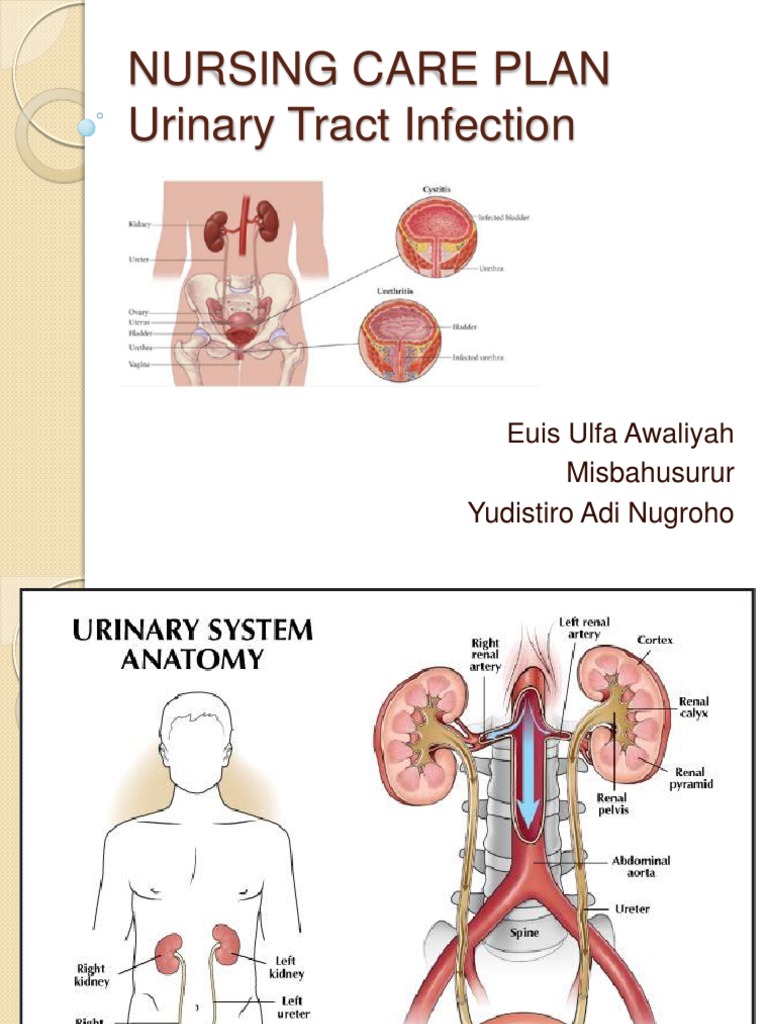 Nursing Care Plan for UTI Management | PDF | Urinary Tract Infection ...