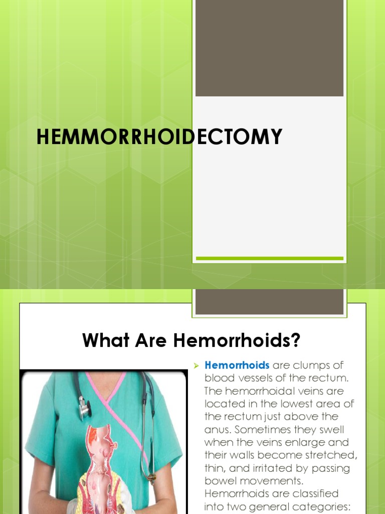 HEMMORRHOIDECTOMY | Hemorrhoid | Thrombosis | Free 30-day Trial | Scribd