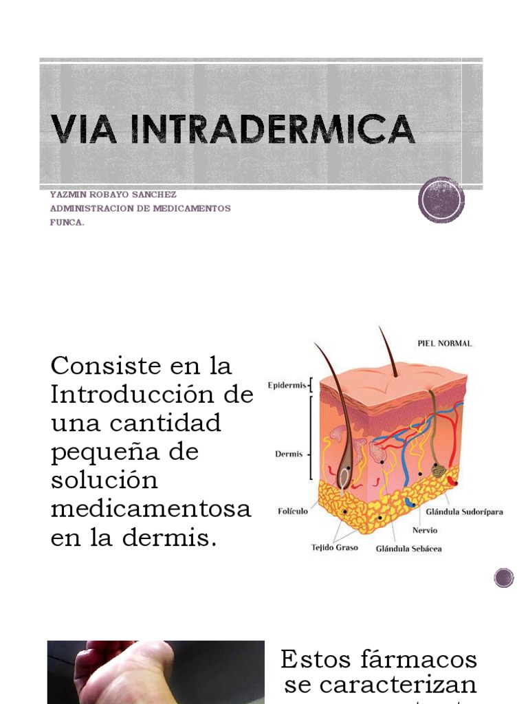 Via Intradermica | PDF