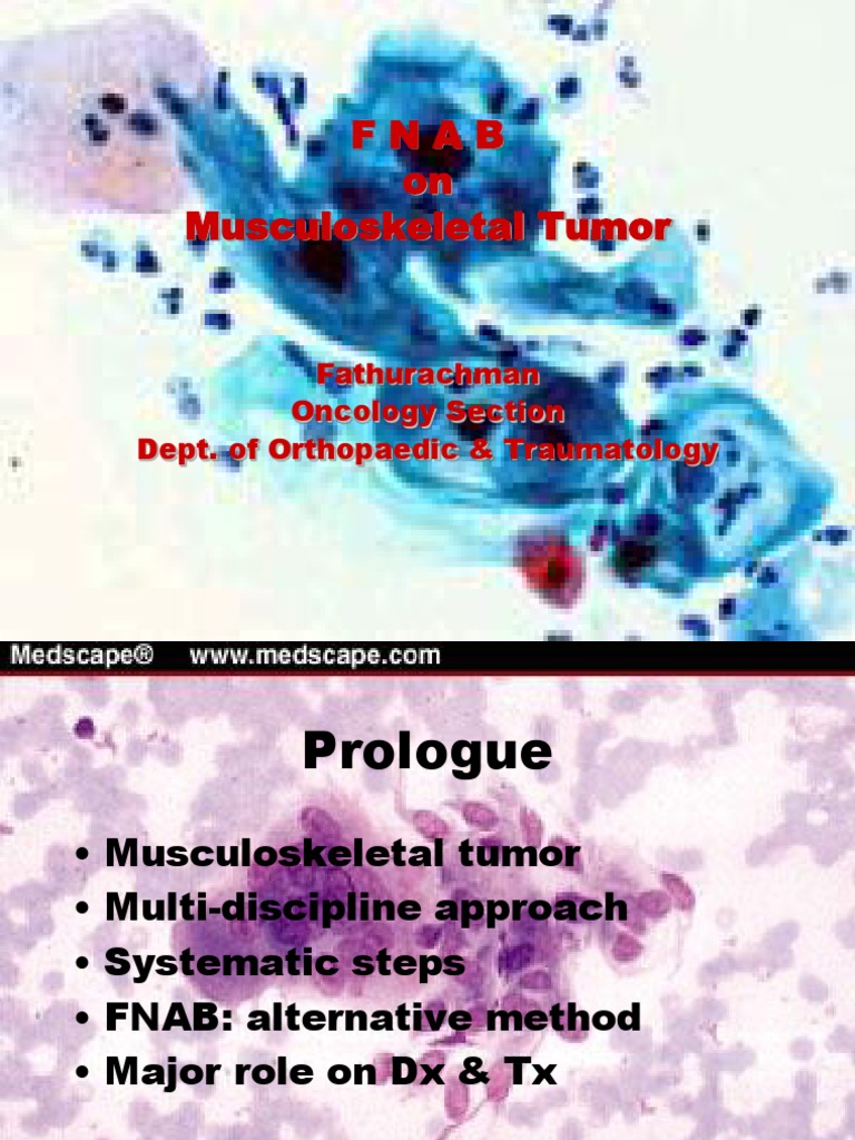Fnab On Musculoskeletal Tumor: Fathurachman Oncology Section Dept. of ...