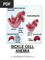 Yale Swallow Protocol PDF | PDF | Sensitivity And Specificity | Medicine
