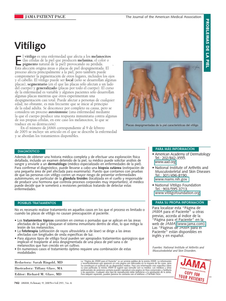 Vitiligo | PDF | Especialidades Medicas | Medicina CLINICA