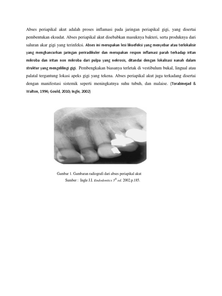 Abses Periapikal Akut | PDF