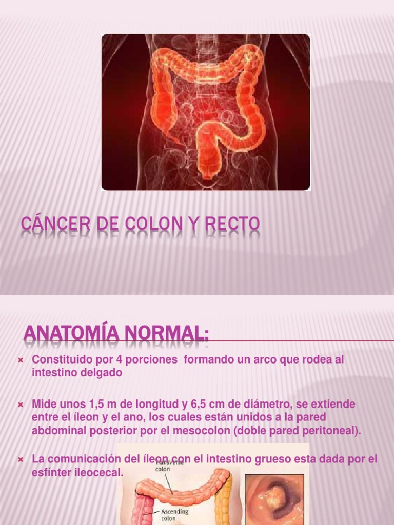 Cáncer De Colon Y Recto | Intestino grueso | Cáncer colonrectal
