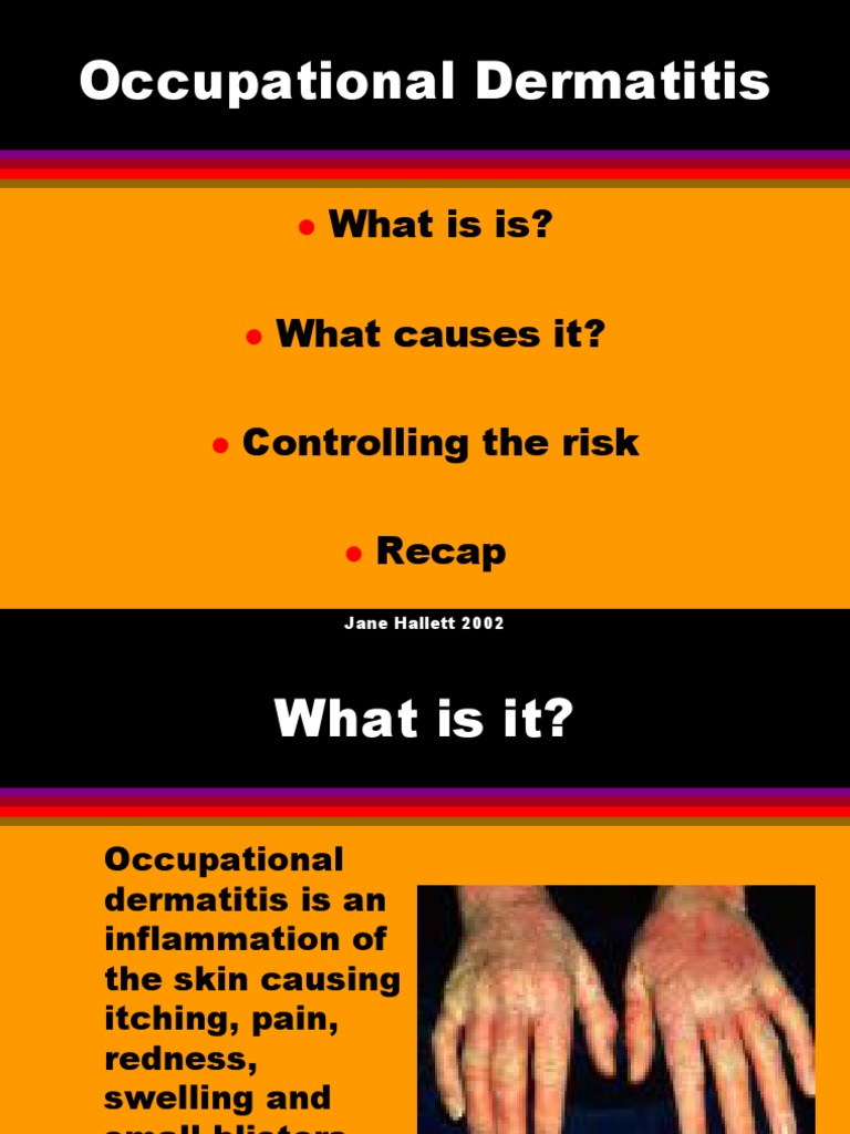 Occupational Dermatitis: What Is Is? What Causes It? Controlling The ...