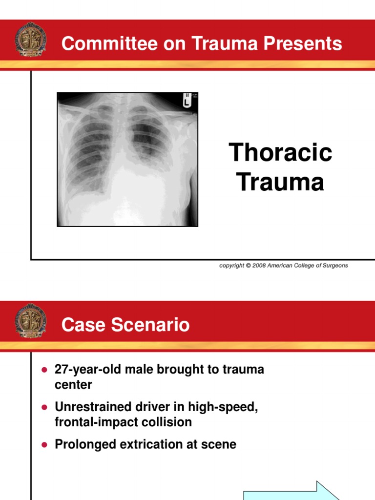 Committee On Trauma Presents | PDF | Major Trauma | Thorax