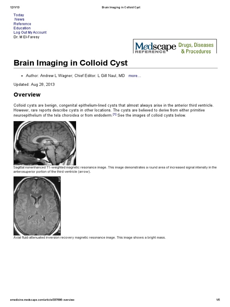 Brain Imaging in Colloid Cyst | PDF | Radiology | Magnetic Resonance ...