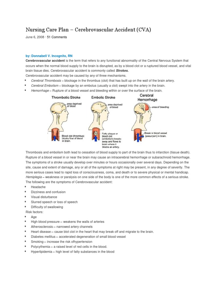 Nursing Care Plan - Cerebrovascular Accident (CVA) : 51 Comments | PDF