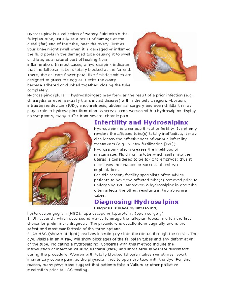 Hydrosalpinx | PDF | Medical Specialties | Sexual Health