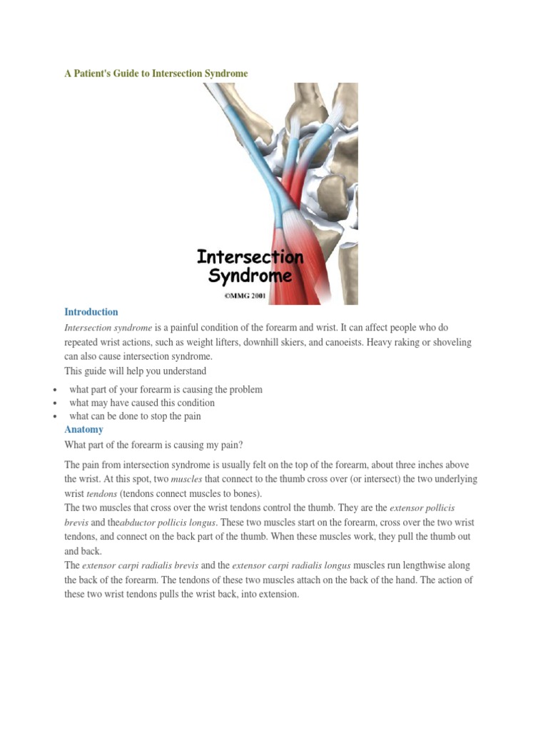 Intersection Syndrome | Download Free PDF | Thumb | Surgery