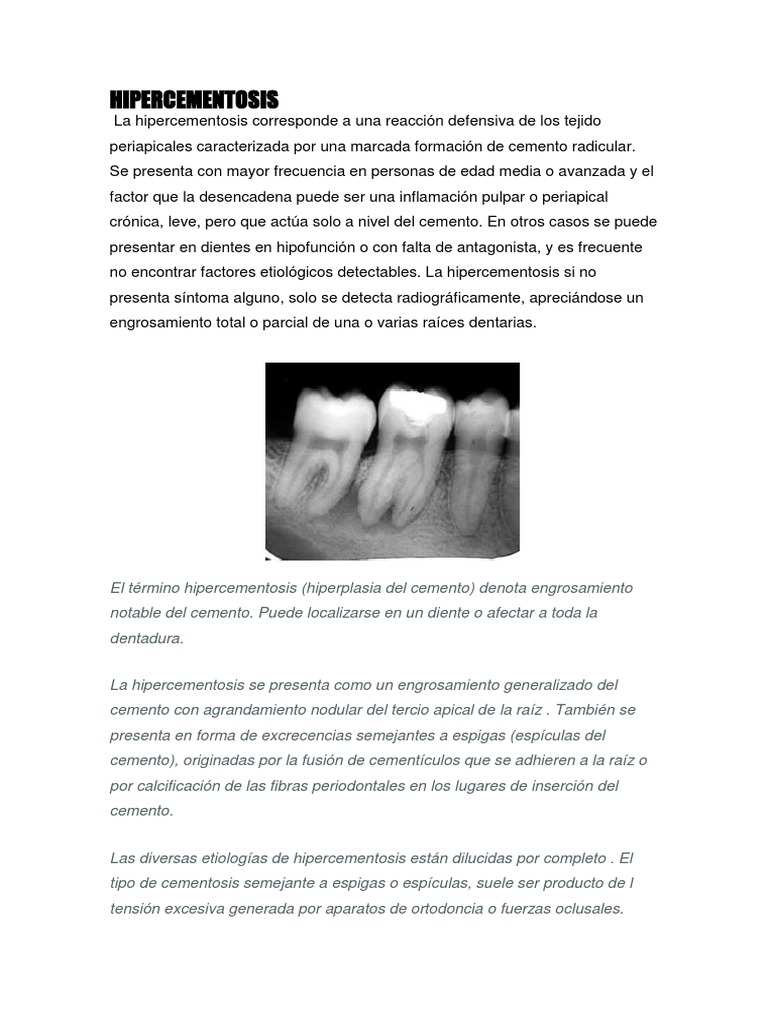 Hipersementosis y Esclerosis Pulpar | PDF