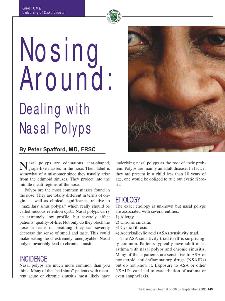 Nasal Polyps | PDF | Medicine | Clinical Medicine