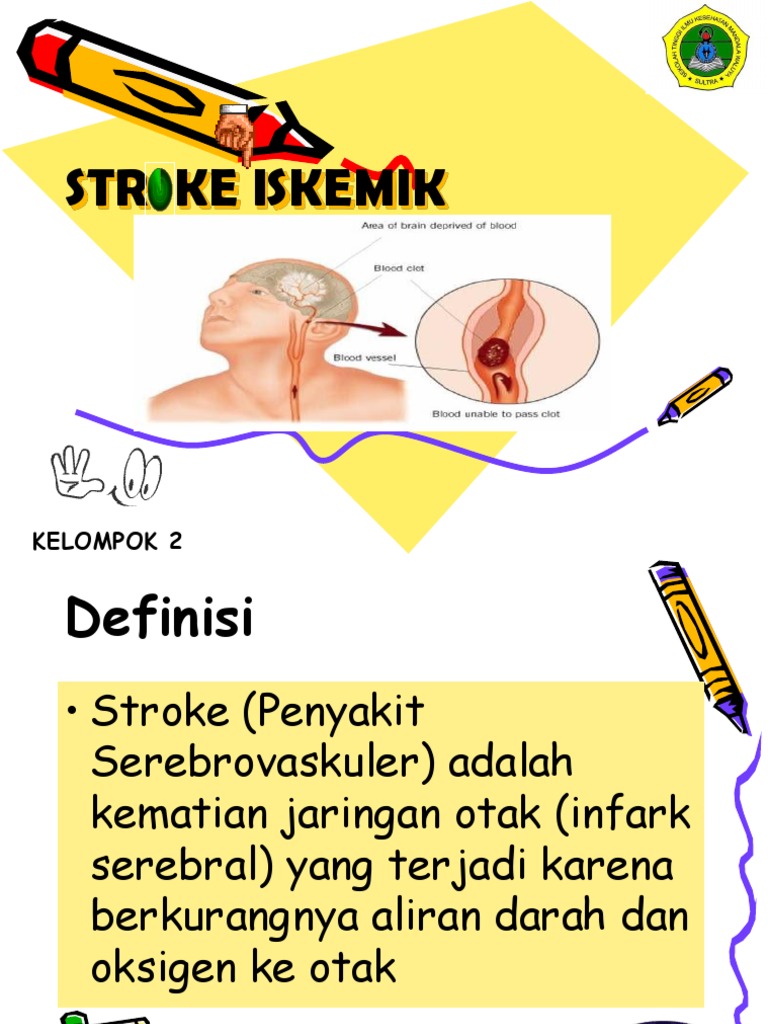 Stroke Iskemik | PDF