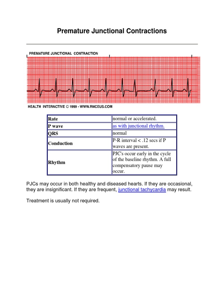 Premature Junctional Contractions | PDF
