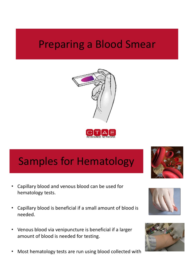 Preparing A Blood Smear | PDF