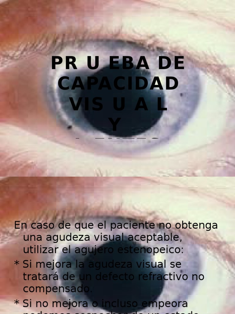 Capacidad visual y lentes estenopeicas | Lentes | Ojo humano | Prueba ...
