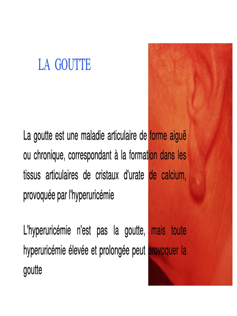 06 goutte.pdf | Goutte (maladie) | Arthrose