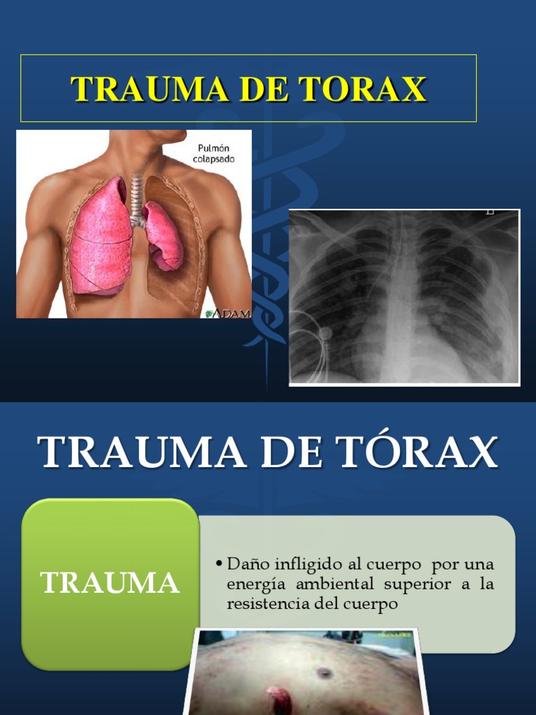 Trauma de Torax | PDF | Lesión | Pulmón