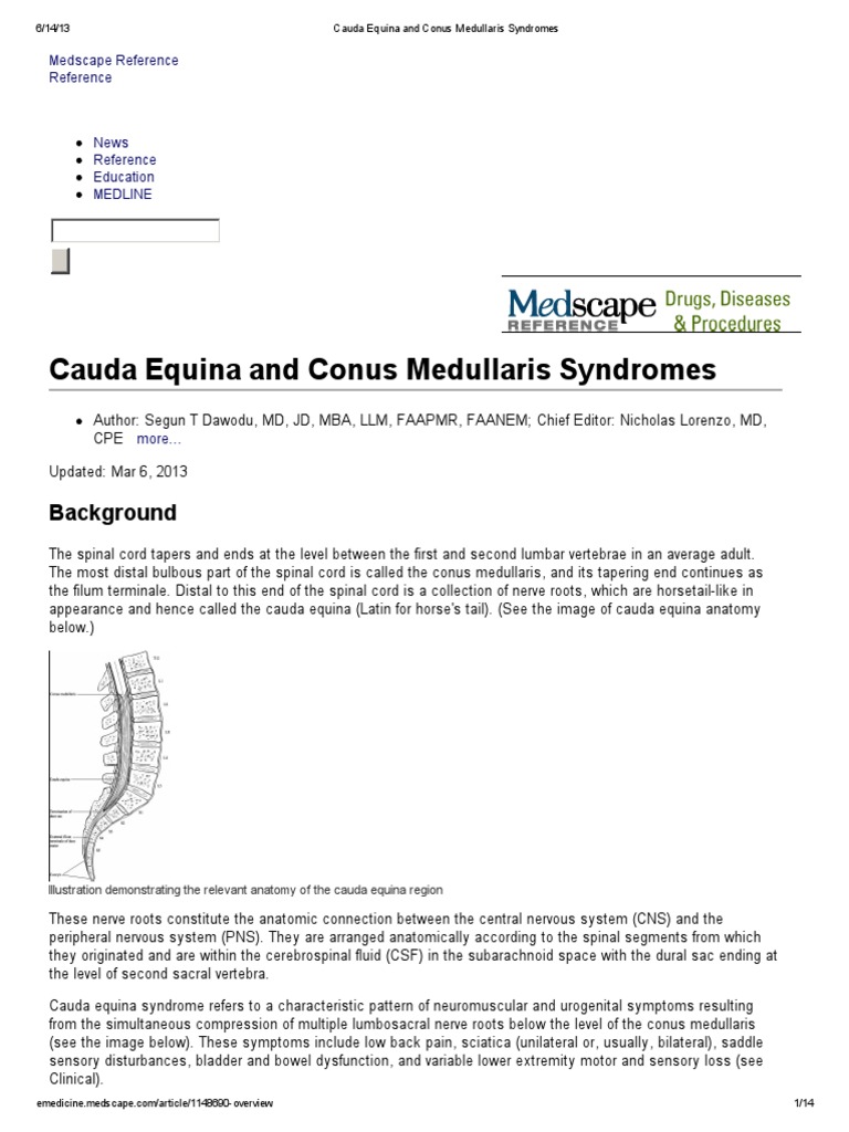Cauda Equina and Conus Medullaris Syndromes | Vertebral Column | Spinal ...
